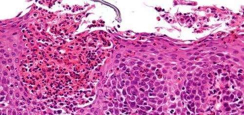 News | Rothenberg CURED Research Lab