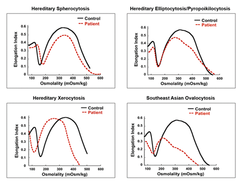 Osmotic Gradient Ektacytometry | Cancer and Blood Diseases Clinical Labs