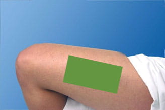 Inyección intramuscular