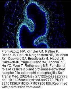 Current Projects | Rothenberg Lab