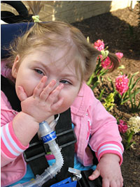 Pediatric Home Ventilator | Cincinnati Children's