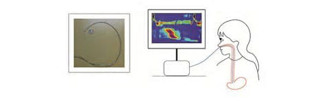 Esophageal Manometry