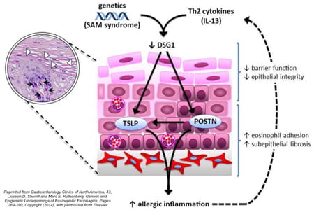 Impaired Barrier Function | Rothenberg Laboratory Current Projects