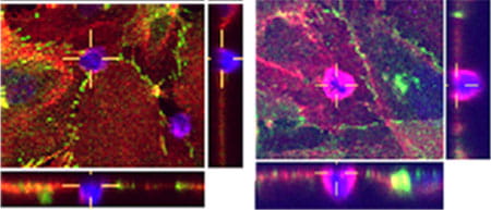 Mechanism of neutrophil migration | Filippi Lab