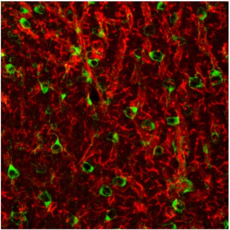 Hepatic Stellate Cells | Yin Lab