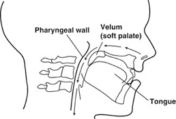 Velopharyngeal Function and Disfunction | Speech-Language Pathology