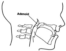 Velopharyngeal Function and Disfunction | Speech-Language Pathology