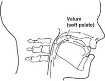 Velopharyngeal Function and Disfunction | Speech-Language Pathology